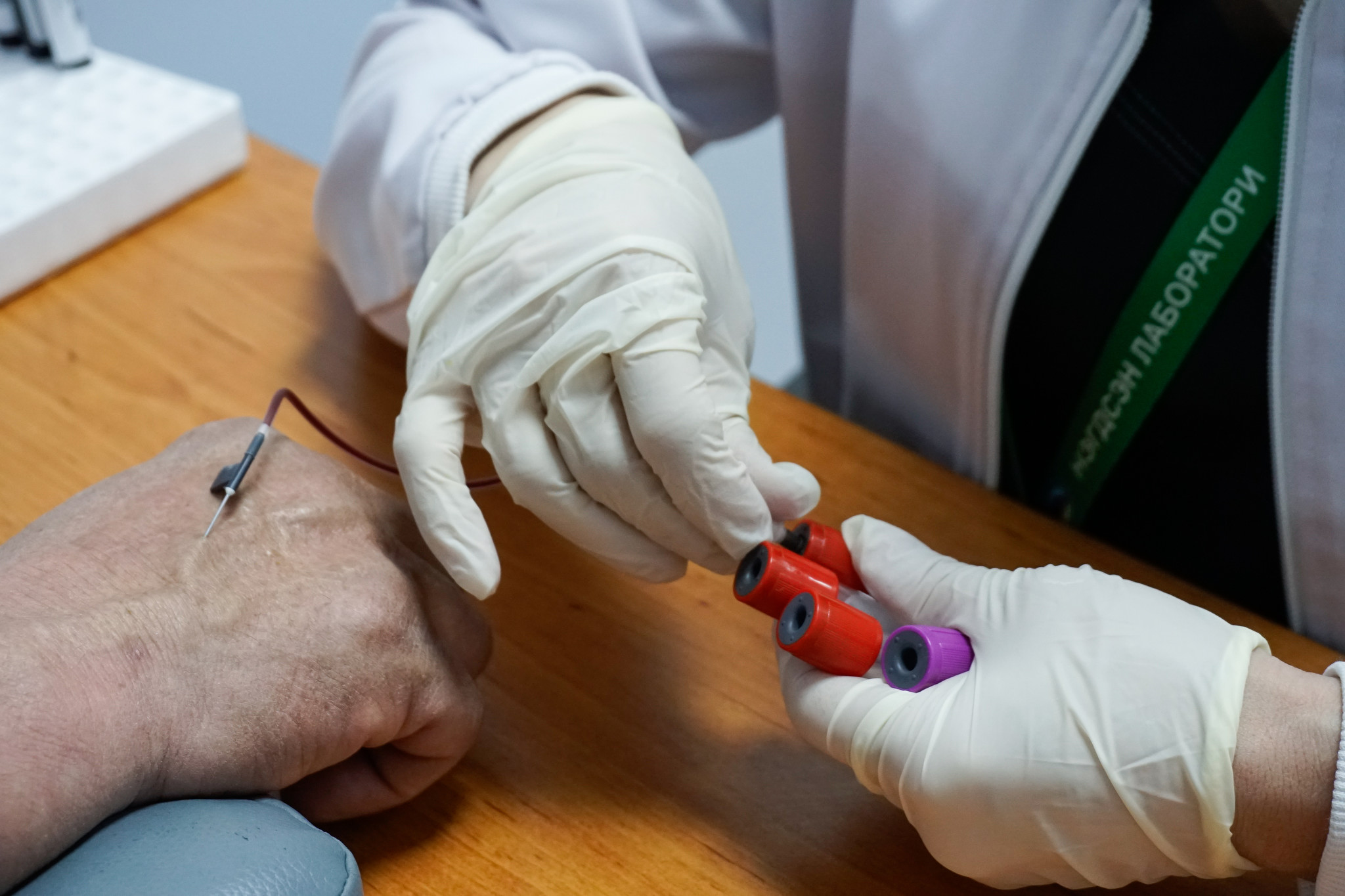 Stomach Cancer Deaths Plummet Under Mongolia’s New Early Detection Program